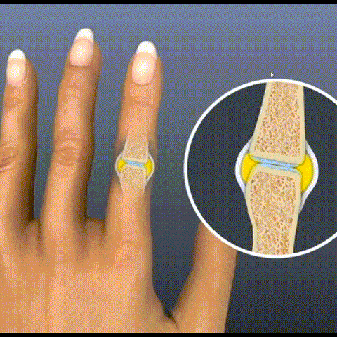 Gout Treatment Snake Venom Potent Ointment – Megamall Online Store