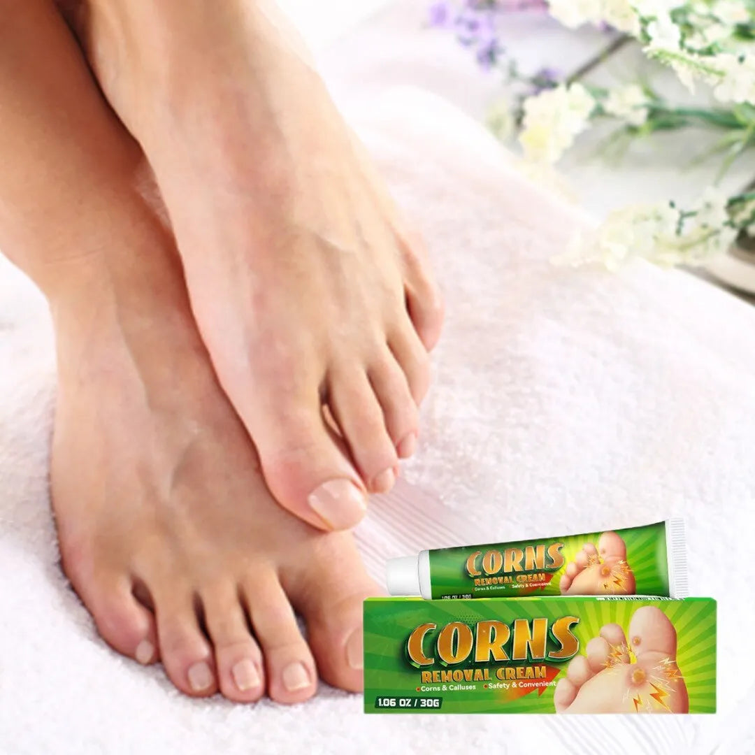 Sumifun Foot Corn Remover Cream Chicken Eye Skin Infection Treatment O ...