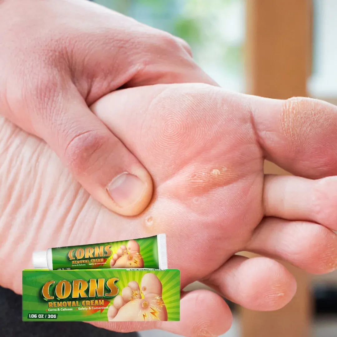 Sumifun Foot Corn Remover Cream Chicken Eye Skin Infection Treatment O ...