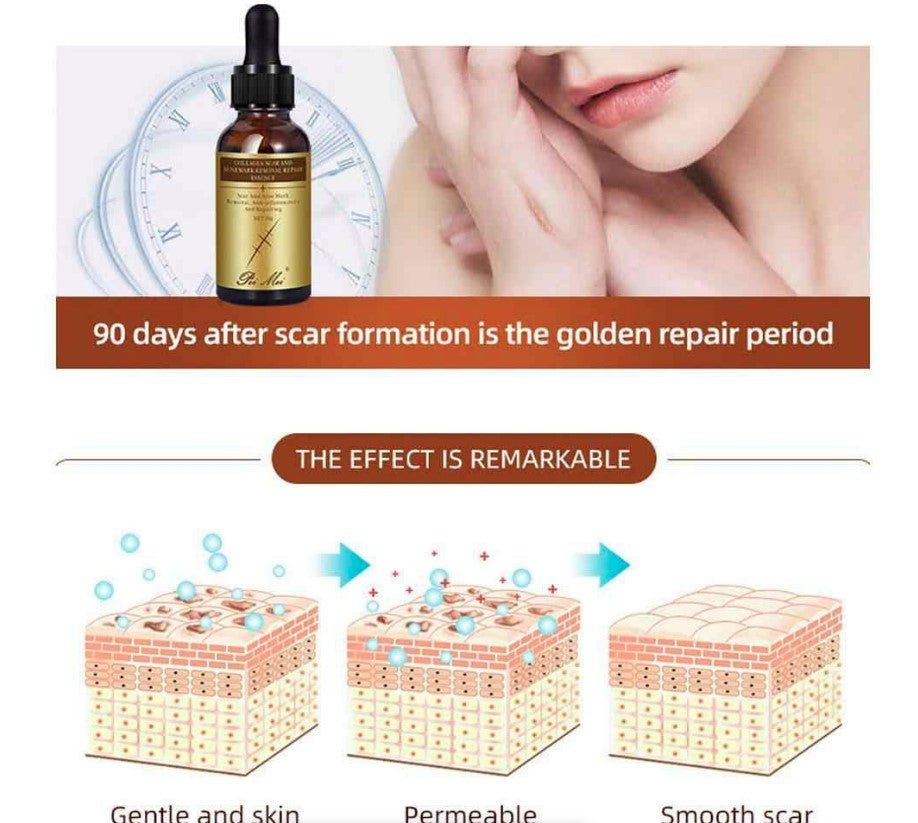 Scar and Acne Mark Removal Repair Essence – Megamall Online Store
